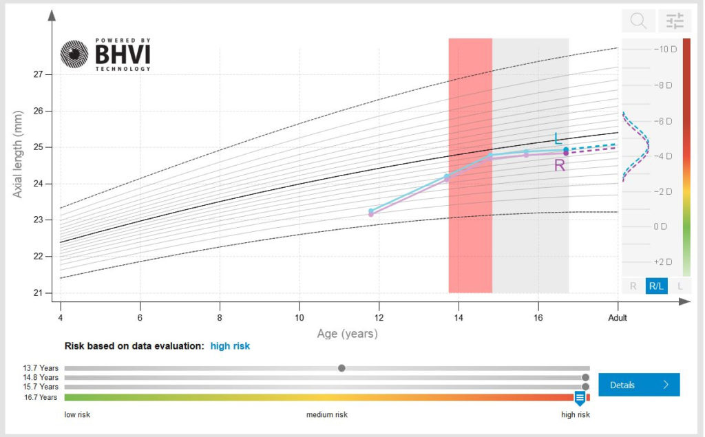 The OCULUS Myopia Master Simplifies and Improves Myopia Management ...