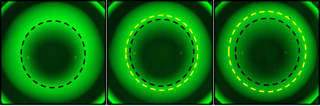 How to Get 'In the Zone' with Orthokeratology and Myopia Management - Review of Myopia Management