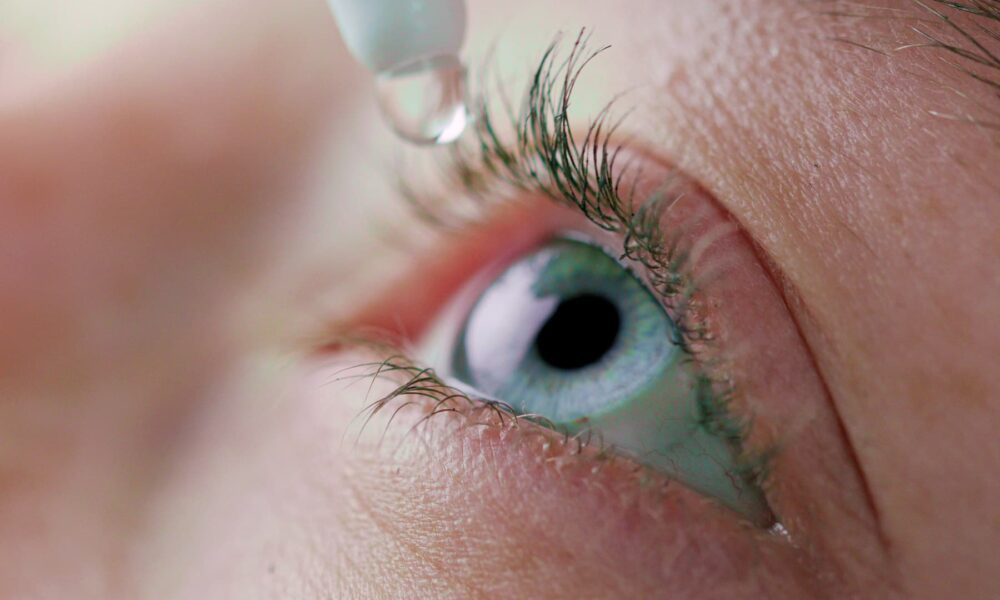 Brien Holden Vision Institute: Myopia Calculator - Review of Myopia ...