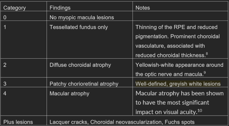 Myopic Maculopathy: What Is It and How Is It Treated? - Review of ...