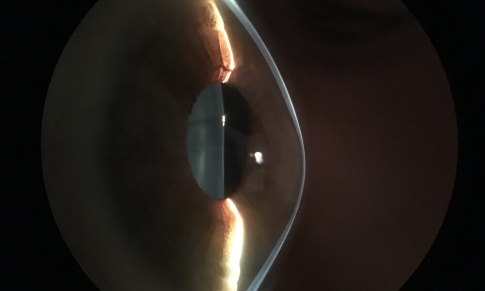 Can Augmented Reality Slow Myopia? - Review of Myopia Management